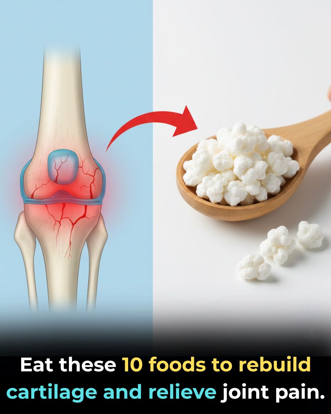 Top 10 Foods to Heal Knee Pain and Boost Cartilage Naturally - All easy ...